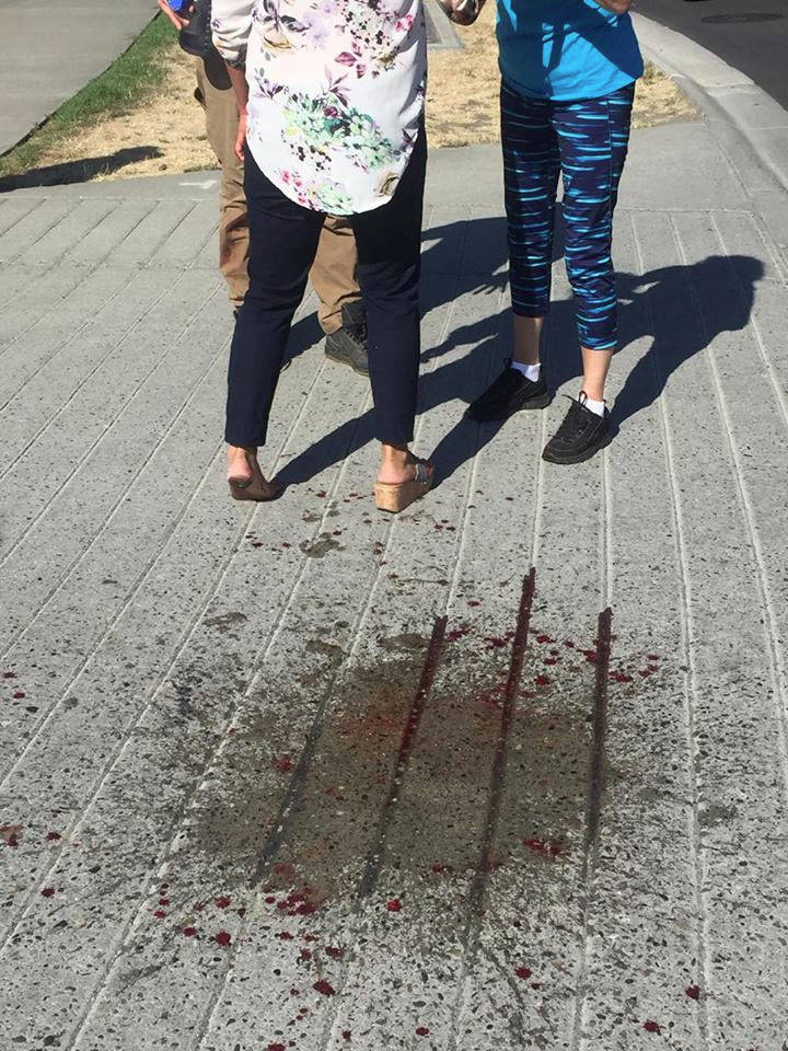 UPDATE: Pit bull owner defends his dog after woman with dog attacked in ...